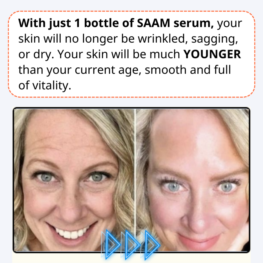 REMOVE SAGGING, WRINKLE, ANTI-AGING | SAAM YOUNG SERUM – Saam Official ...