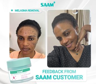 SAAM Renewal Face Cream for Melasma Treatment