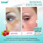 SAAM Renewal Face Cream for Melasma Treatment