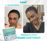 SAAM Renewal Face Cream for Melasma Treatment