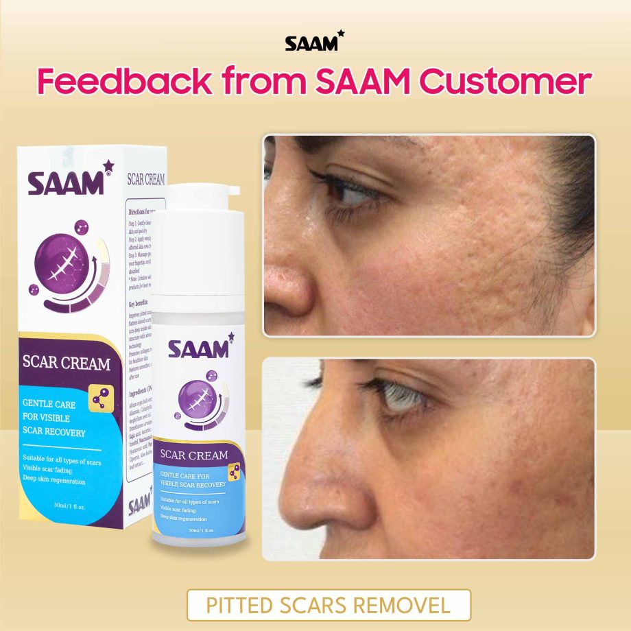 SAAM Cream reduce scar appearance for smoother skin