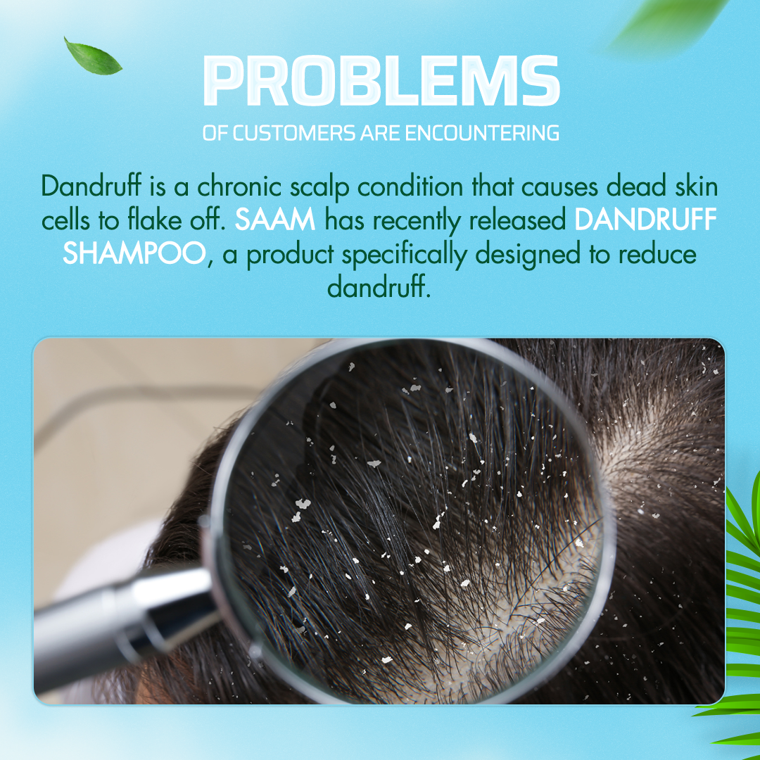 NO MORE WORRIES ABOUT DANDRUFF WITH SAAM DANDRUFF SHAMPOO 150ML - saam ...
