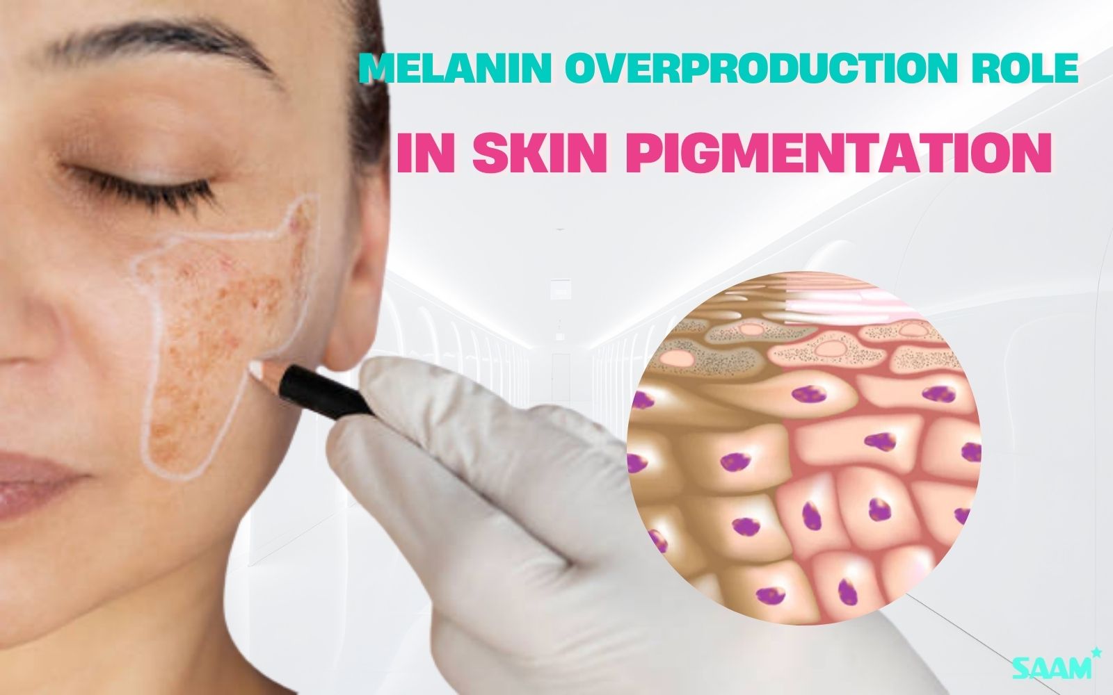Melasma and Freckles: Differences And Effective Solutions